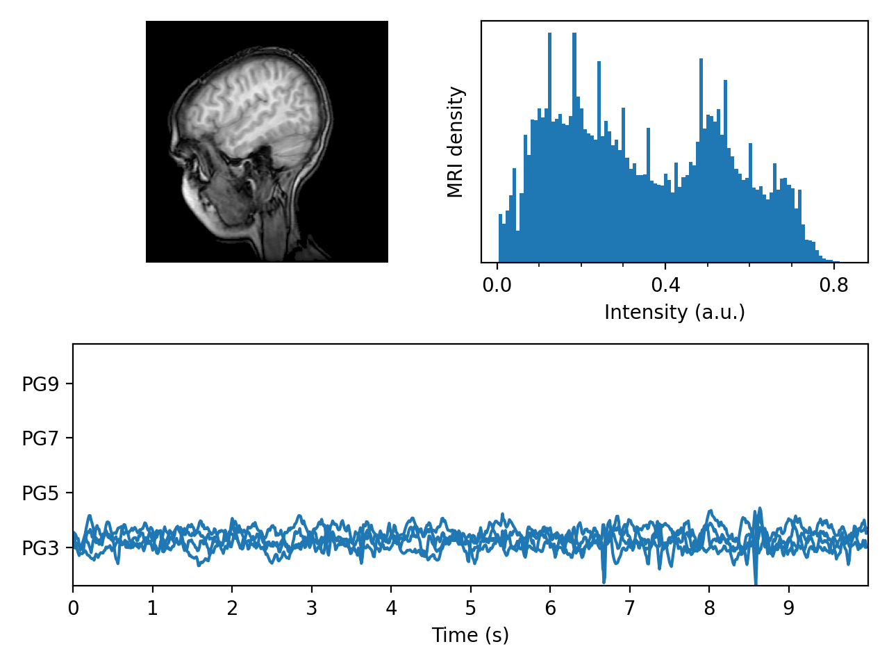 脳波付きMRI_Matplotlib - Pythonの可視化